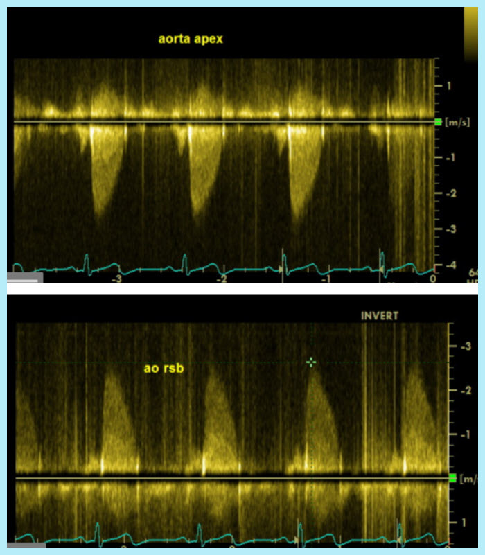 Qi Quiz Test Echo Iac 4988