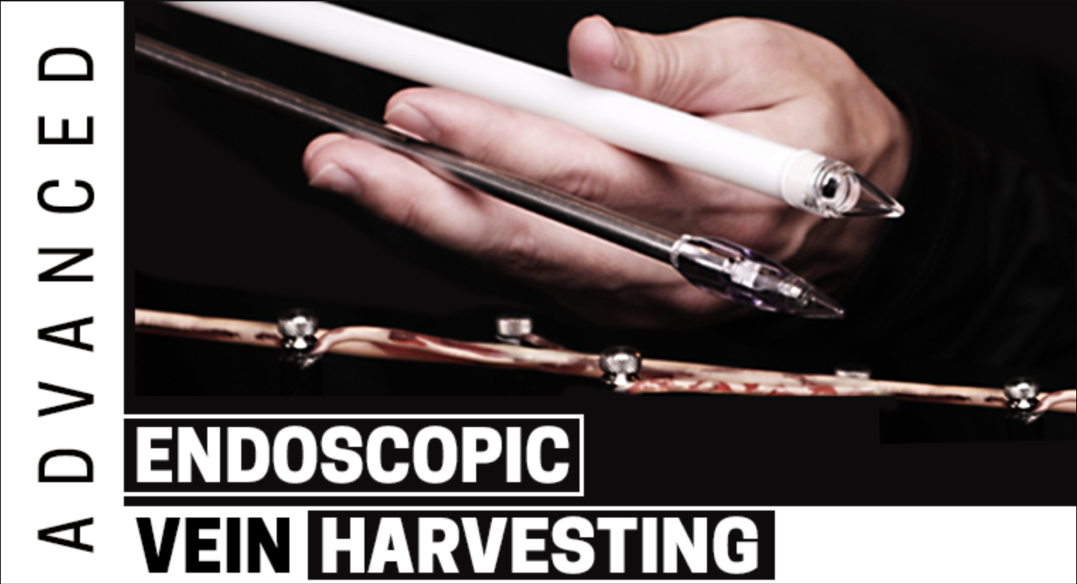 Advanced Endoscopic Vein Harvesting - IAC
